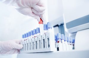 DNA Tests | Genetrack Canada